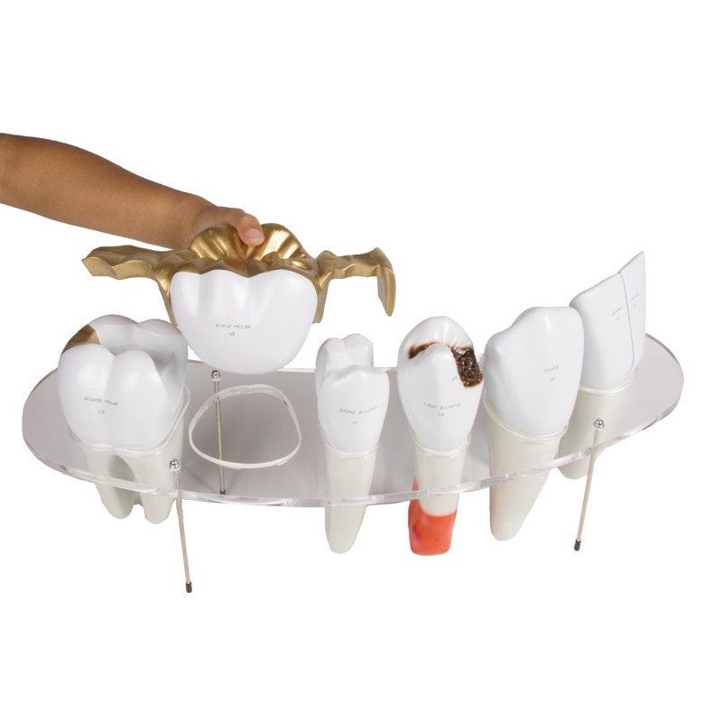 Enlarged Dental Morphology Model | Health and Care